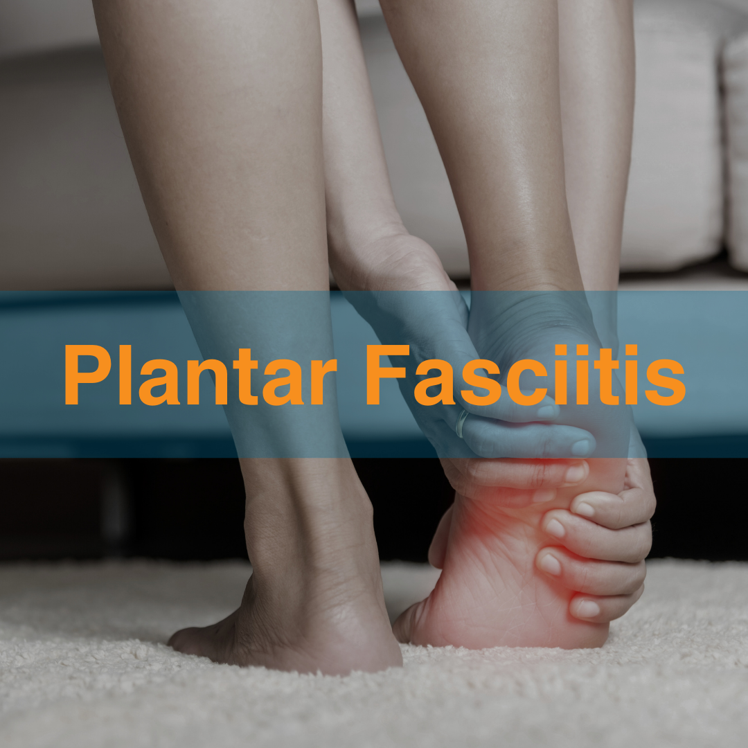 Plantar Fasciitis | Montgomery Sports Medicine